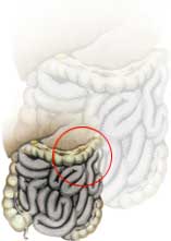 Dr. Nevton - Ginecologia